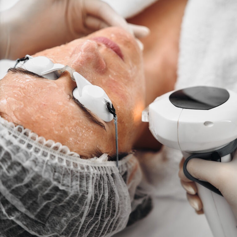 Smart Acne Scar Treatment 2026 | Reveal Clinics Riyadh